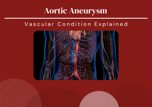 Aortic Aneurysm – Glendale Vascular